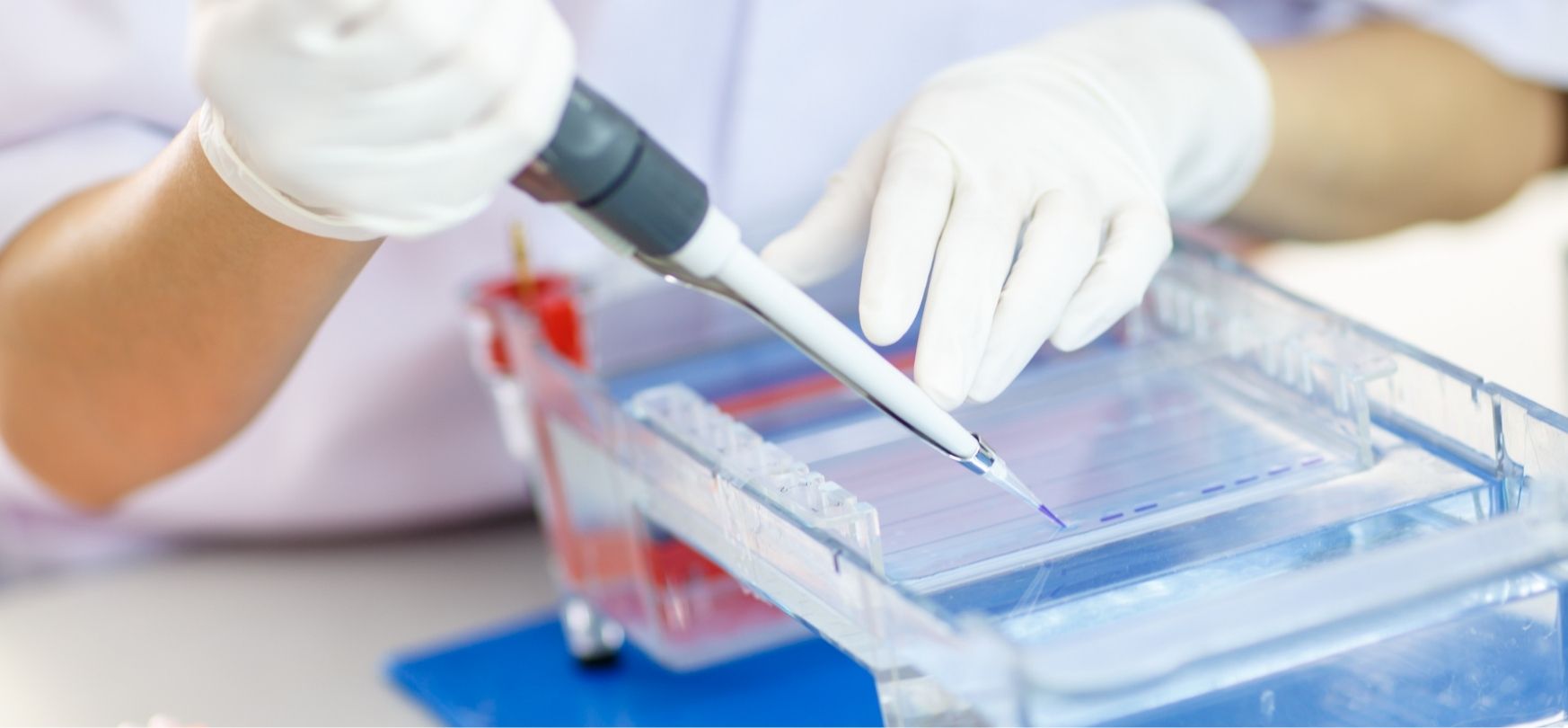How to Interpret DNA Gel Electrophoresis Results | GoldBio